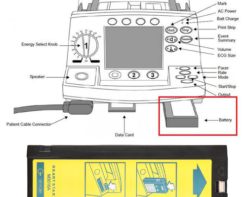 How to Find Your Patient Monitor Model & Battery Type - BatteryMall.com